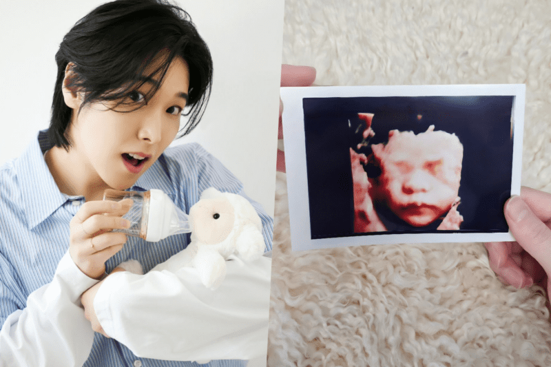Super Junior's Sungmin to Welcome First Baby After 10 Years of Marriage ...