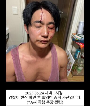 Musical Actor Jeon Ho Jun Posts Bloody Pics of Himself Amid Ex's ...