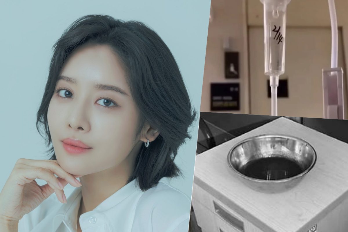 Cha Joo Young Recovering After Surgery for Chronic Nosebleeds, Sung Si ...